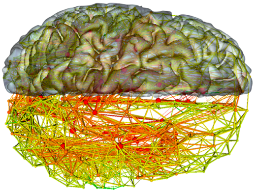 In Brain’s ‘Rich Club,’ Meetings of the Mind | Quanta Magazine