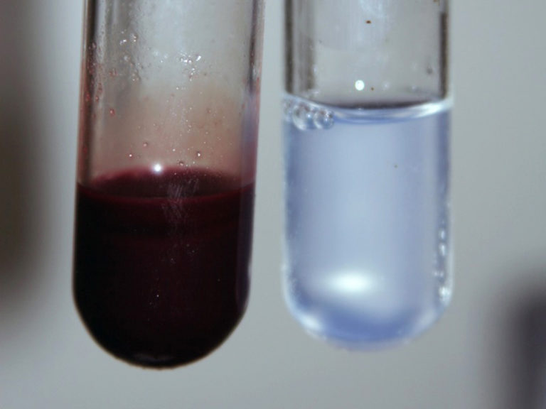 Icefish Study Adds Another Color to the Story of Blood | Quanta Magazine