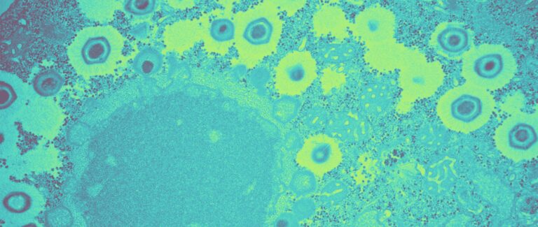 Undergraduate Math Student Pushes Frontier of Graph Theory | Quanta ...