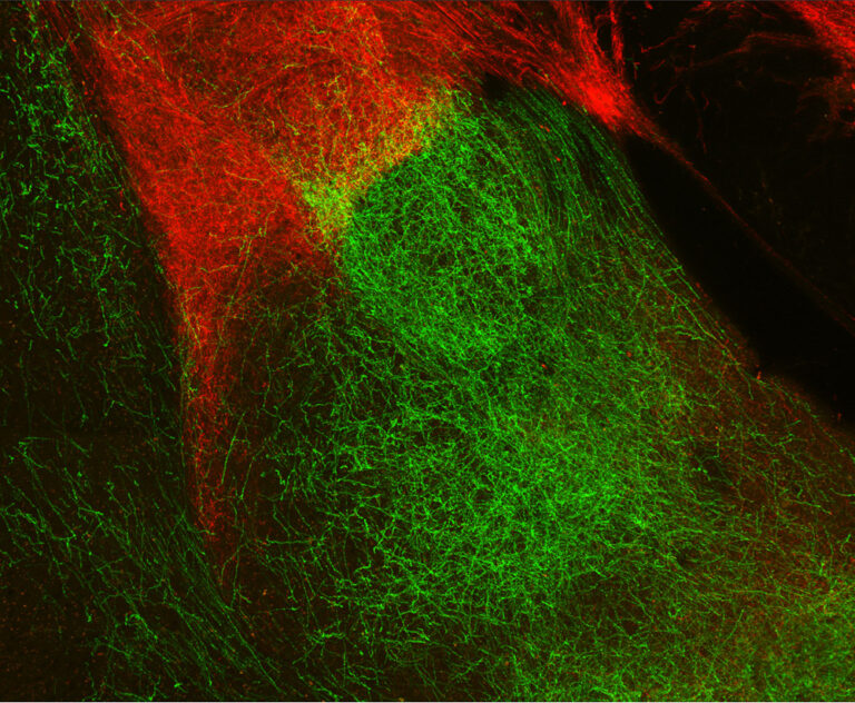 A Good Memory or a Bad One? One Brain Molecule Decides. | Quanta Magazine