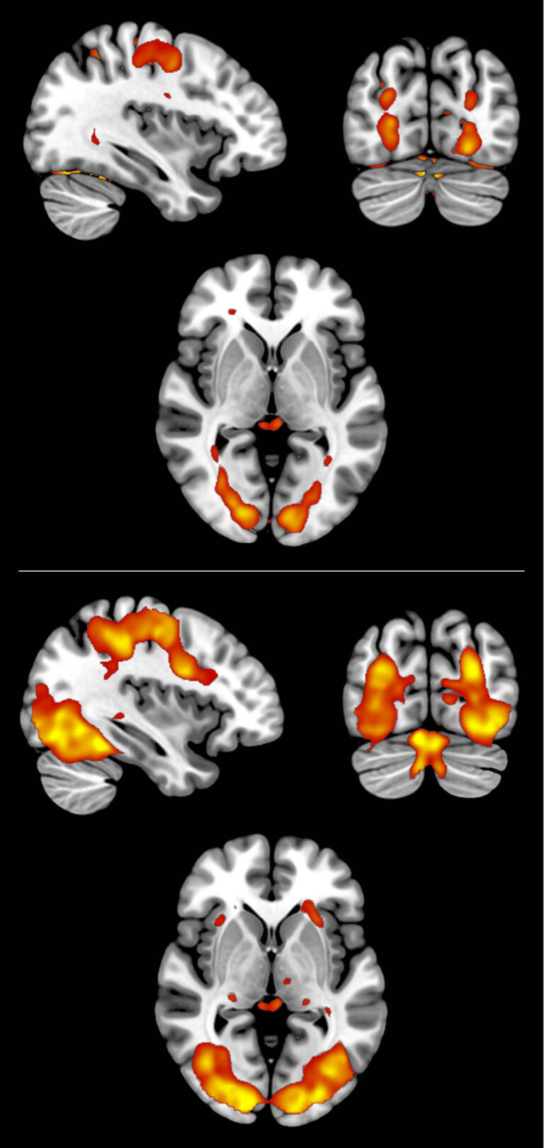 Is It Real or Imagined? How Your Brain Tells the Difference. | Quanta ...