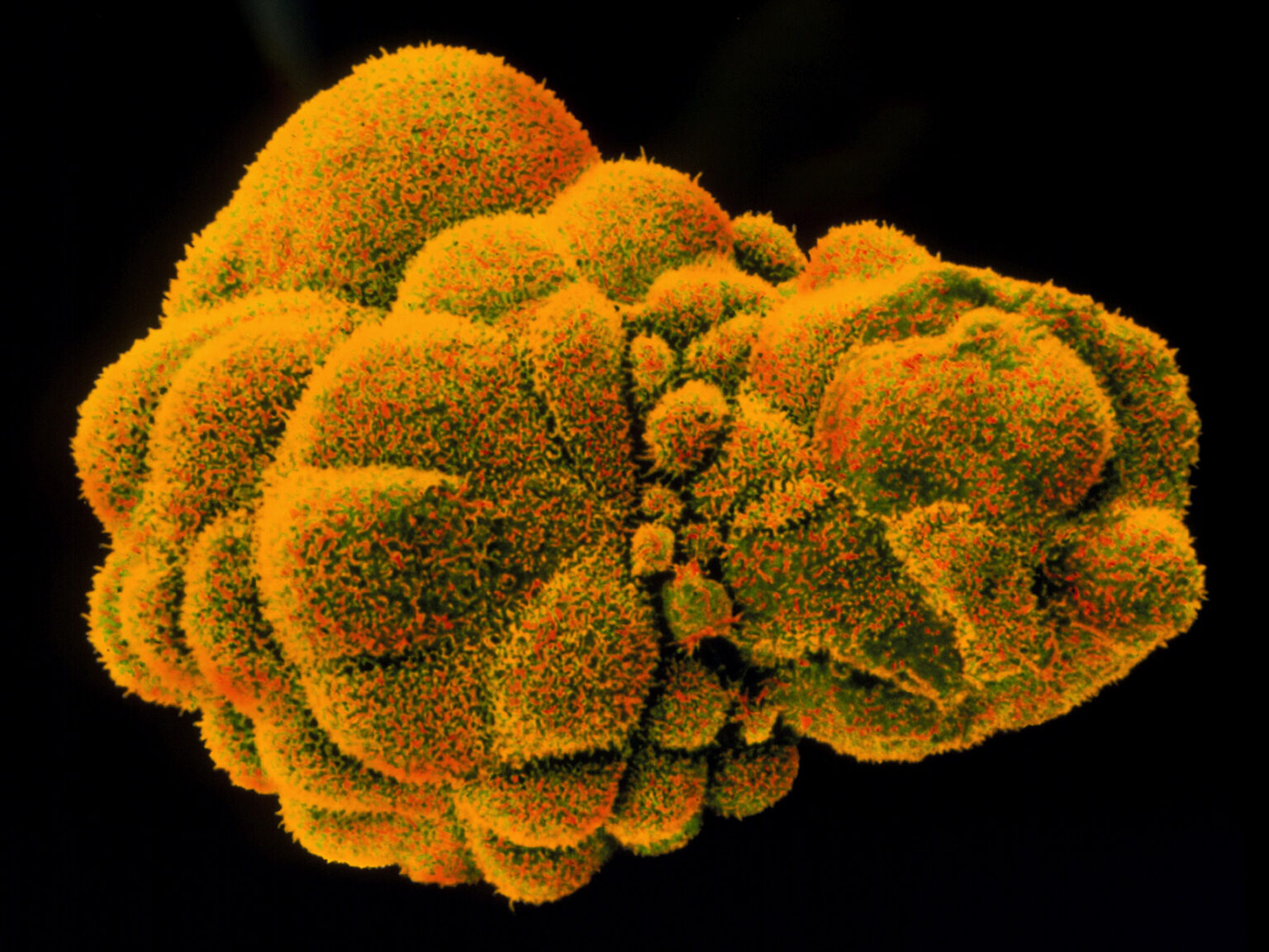 ‘Embryo Models’ Challenge Legal, Ethical and Biological Concepts ...